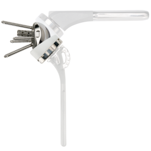 Equinoxe Reverse System | Total Shoulder Arthroplasty | Exactech