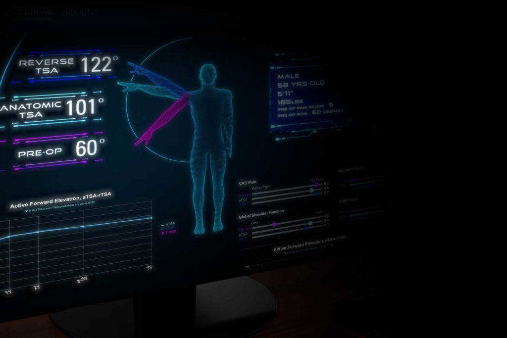 Predict+ Patient-Specific Outcome Predictor | Exactech